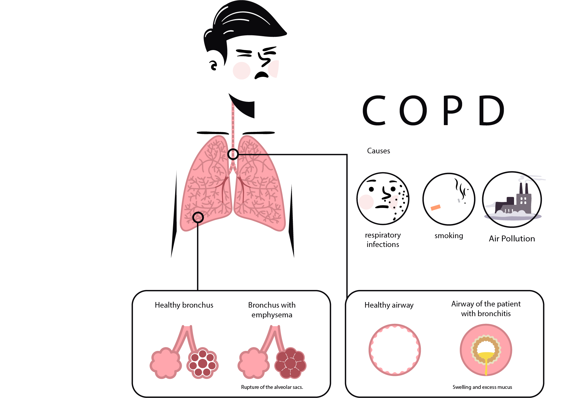 Finding the Right COPD Specialist for You is Essential!
